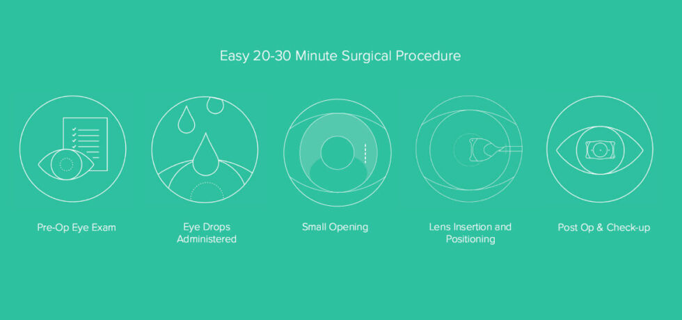 ICL Eye Surgery | Sambursky Eye and Esthetics